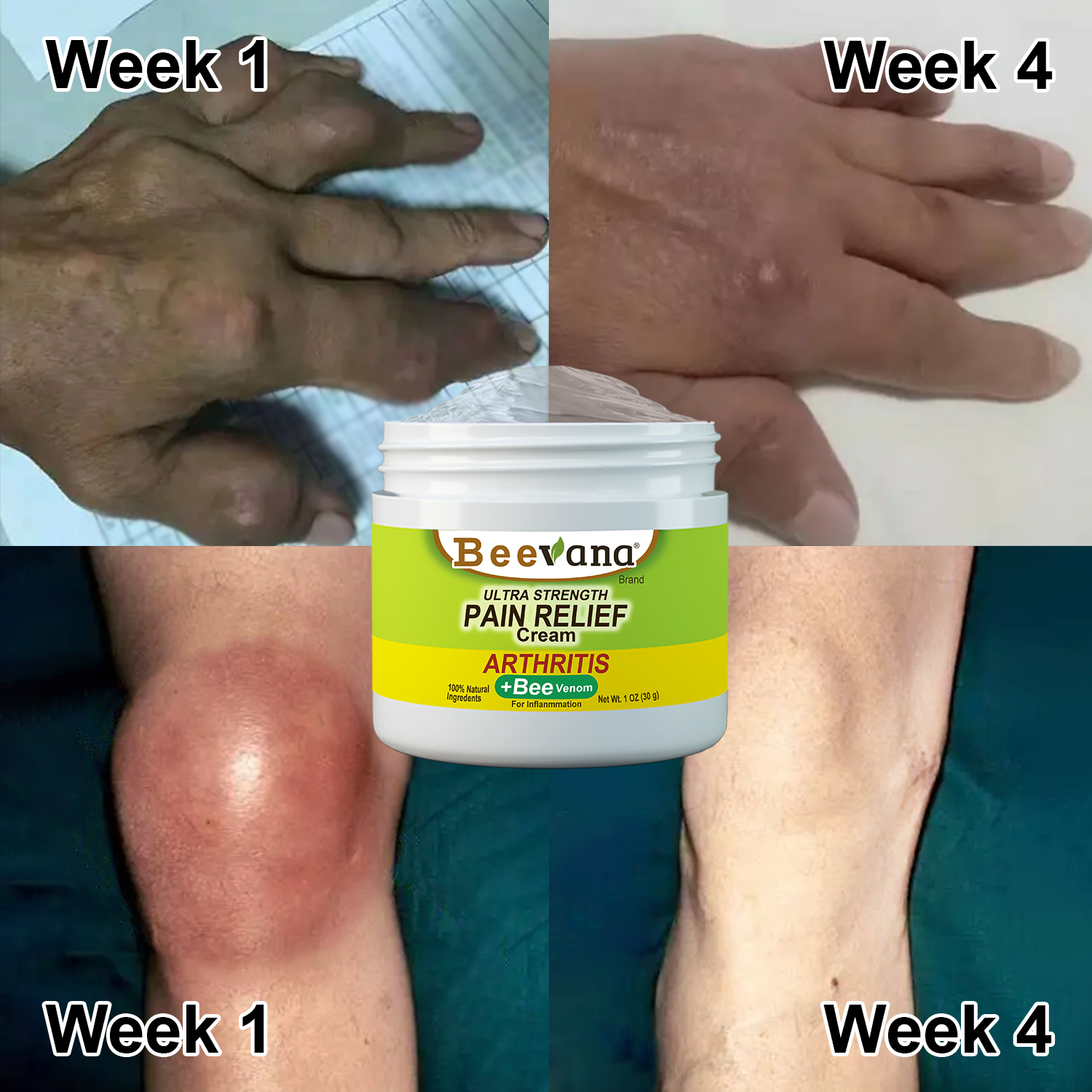 Arthritis Pain Relief Cream | Joint & Bone Therapy | Deep Cleansing ...