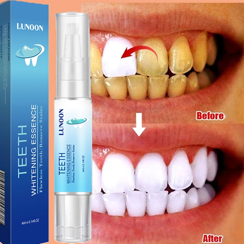 Best Teeth Whitening Pen | Teeth Whitening Essence | Deep Cleansing ...