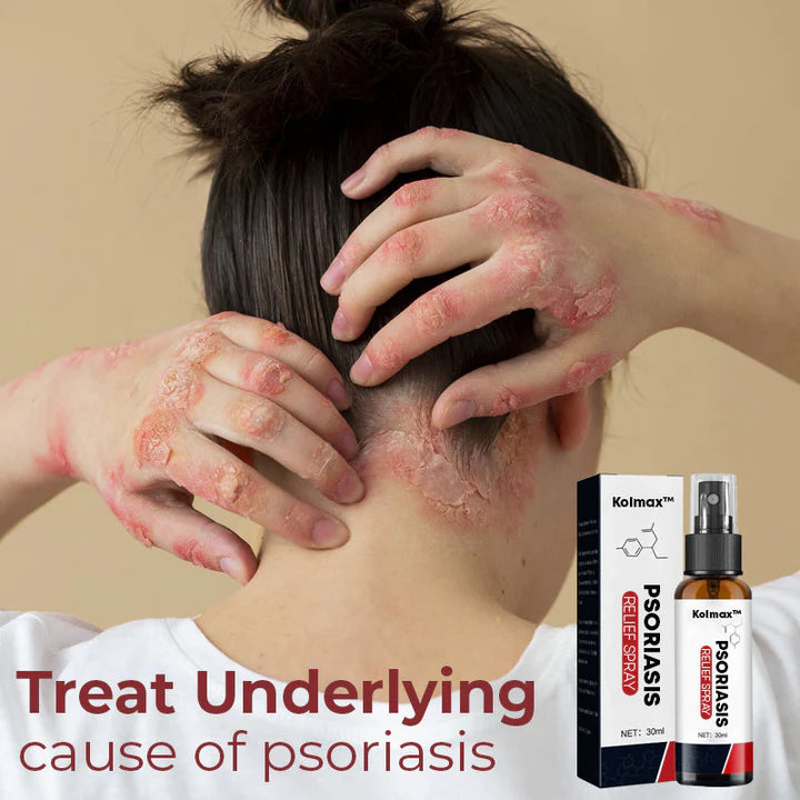Kolmax™ Psoriasis Relief Spray – DEEPCLEANSING